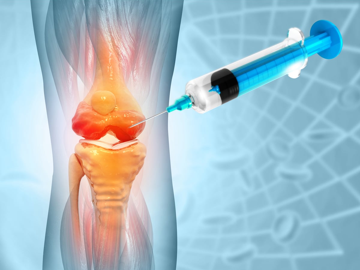 How PRP Injections Are Changing the Game for Orthopedic Care | Alaska ...